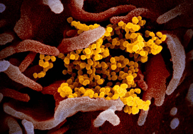 Fact check: The theory that SARS-CoV-2 is becoming milder